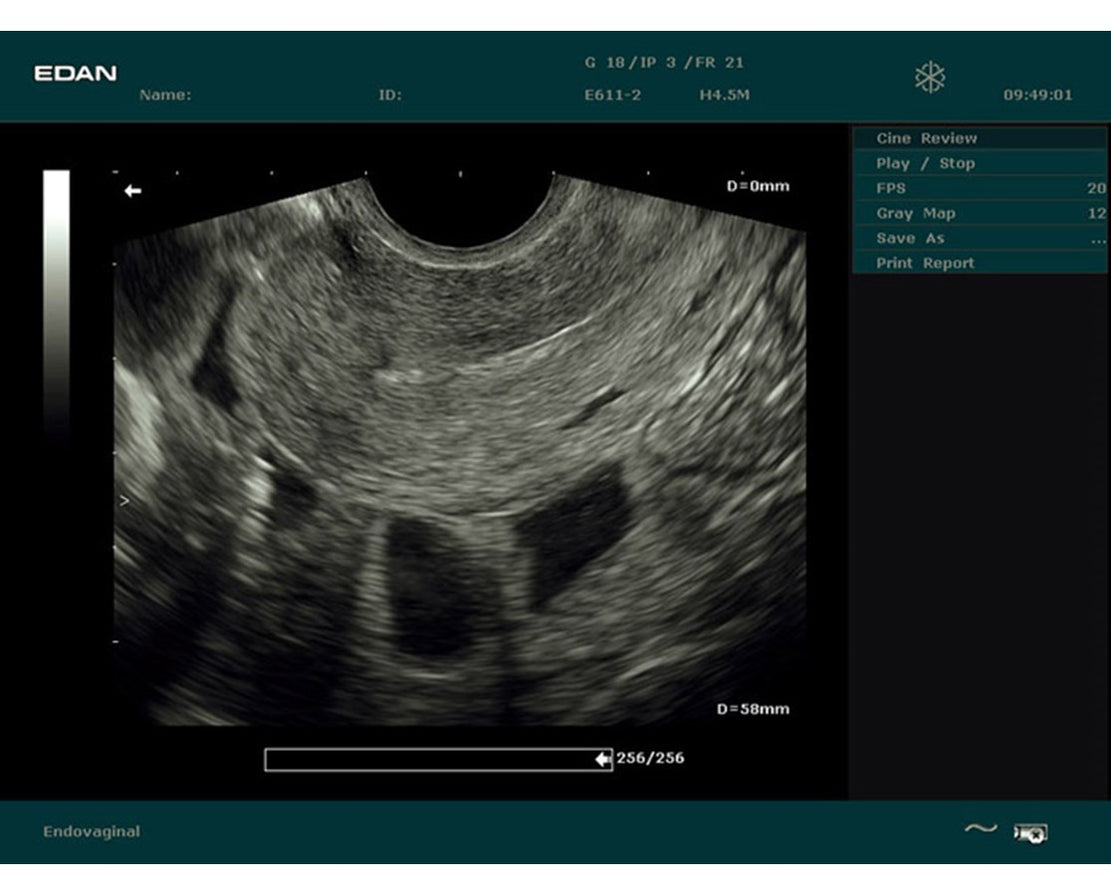 Edan Digital Ultrasonic Diagnostic Imaging System - Save at — Tiger Medical