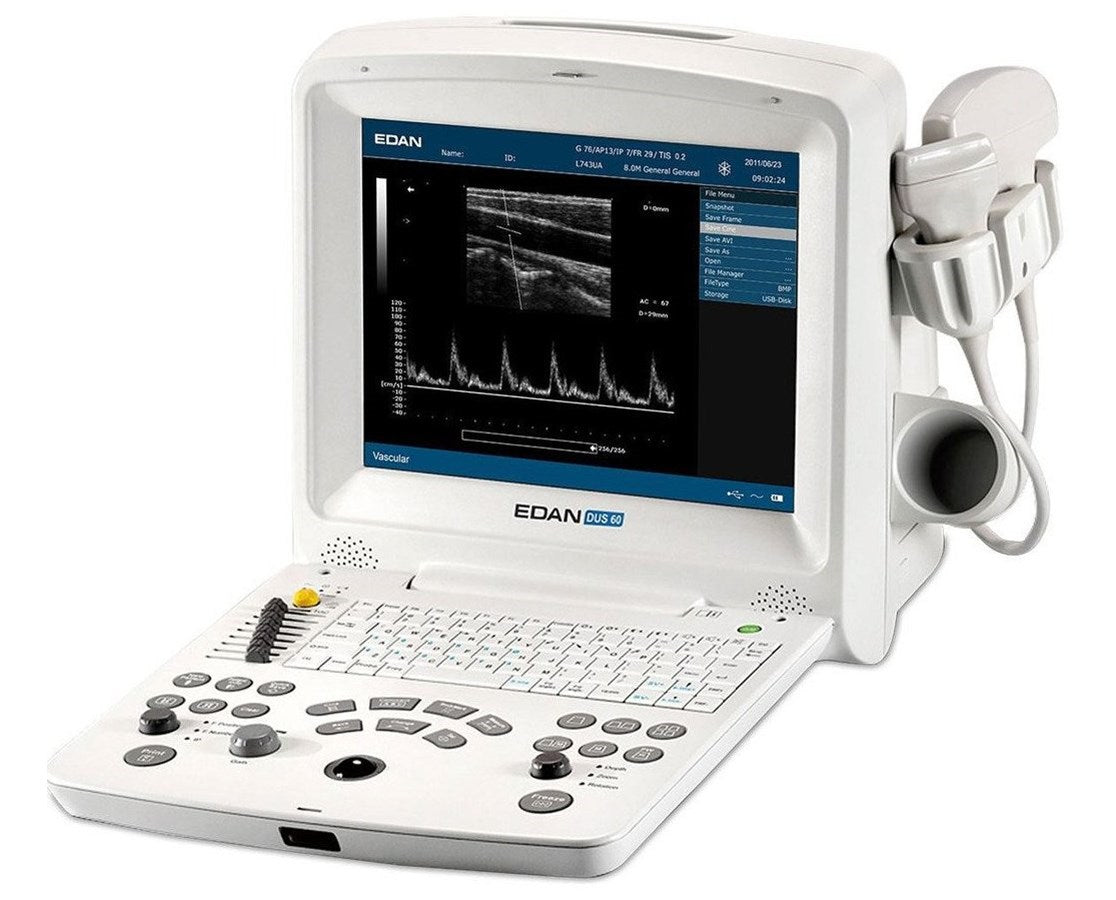 Edan Digital Ultrasonic Diagnostic Imaging System. Save at Tigermedical ...