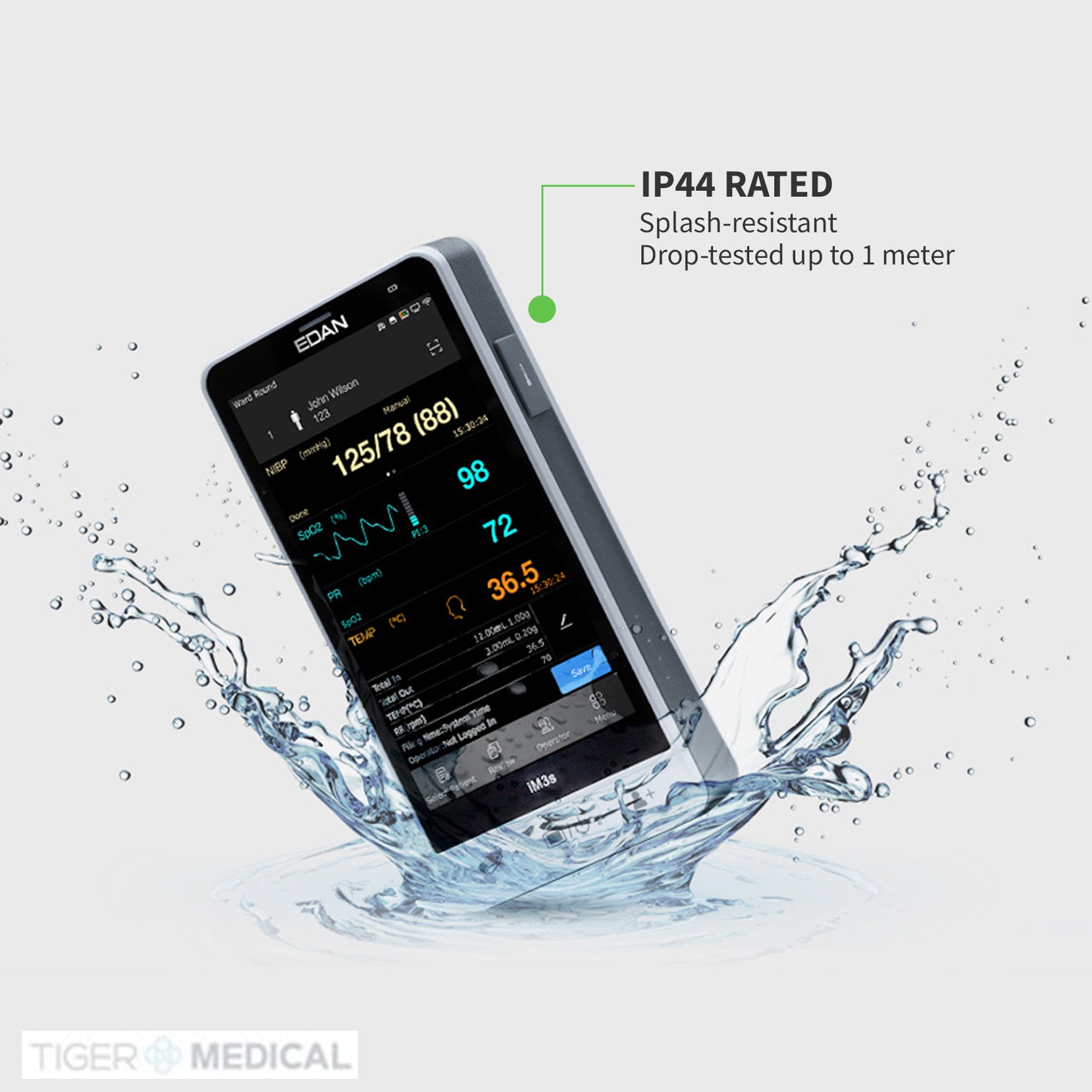Edan iM3s Handheld Vital Signs Monitor. Save at Tigermedical — Tiger ...