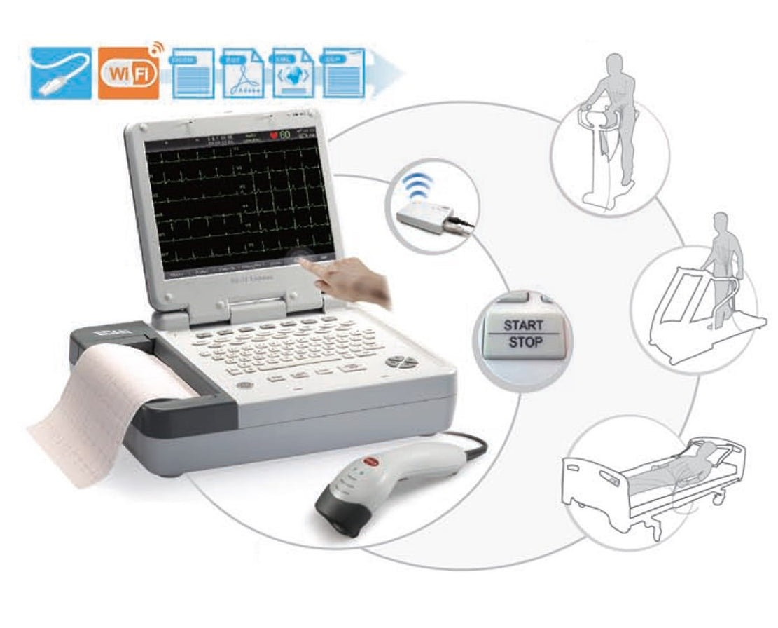 Edan Express 12-Channel ECG Machine - Save at — Tiger Medical