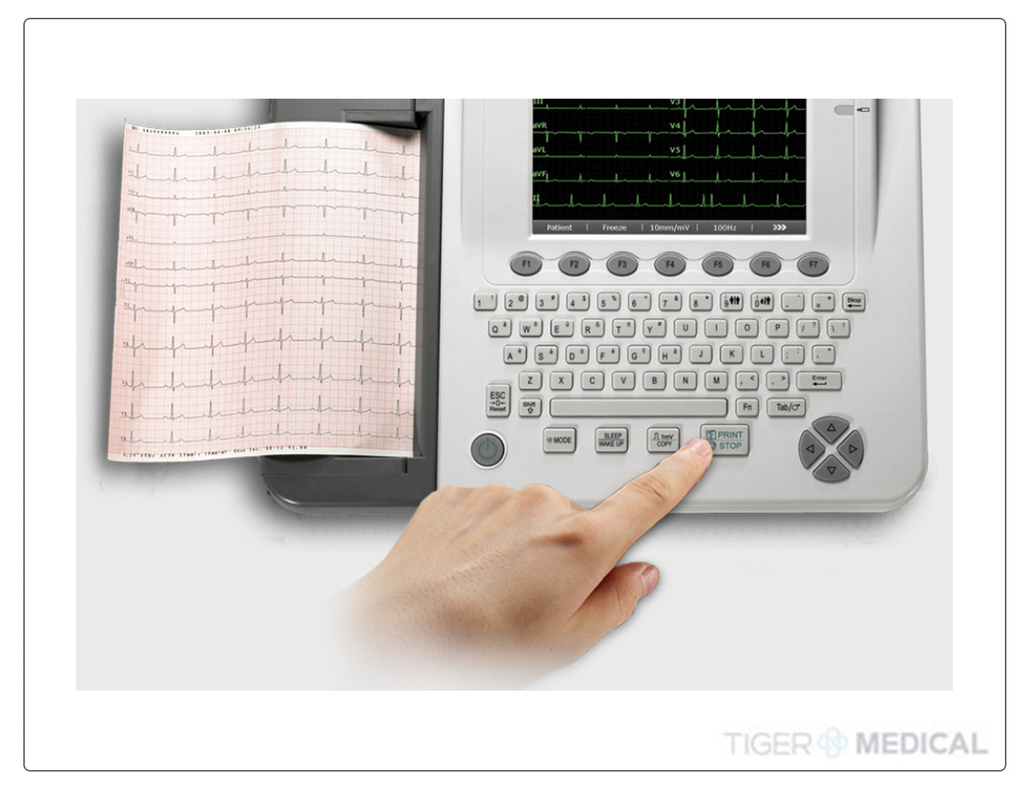 Edan Express 12-Channel ECG Machine - Save at — Tiger Medical