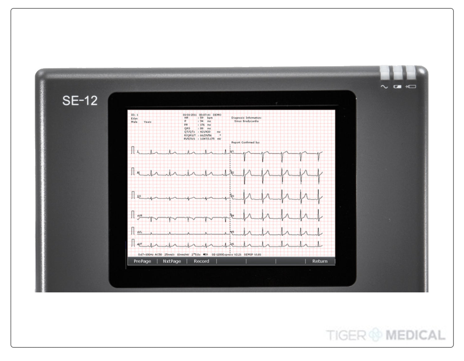 Edan Express 12-Channel ECG Machine - Save at — Tiger Medical