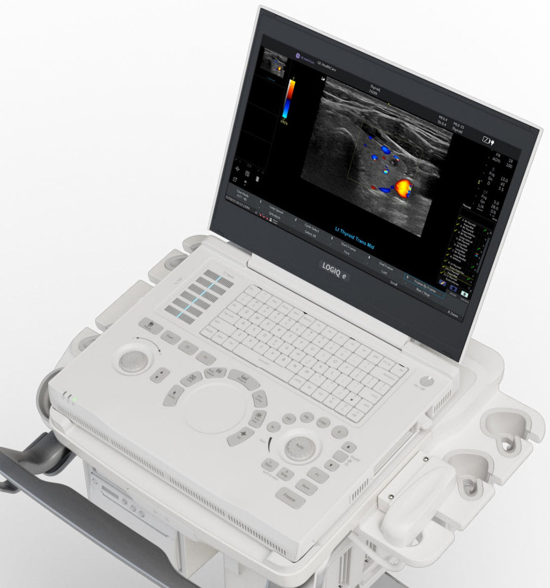 GE LOGIQ E Ultrasound. Save at — Tiger Medical
