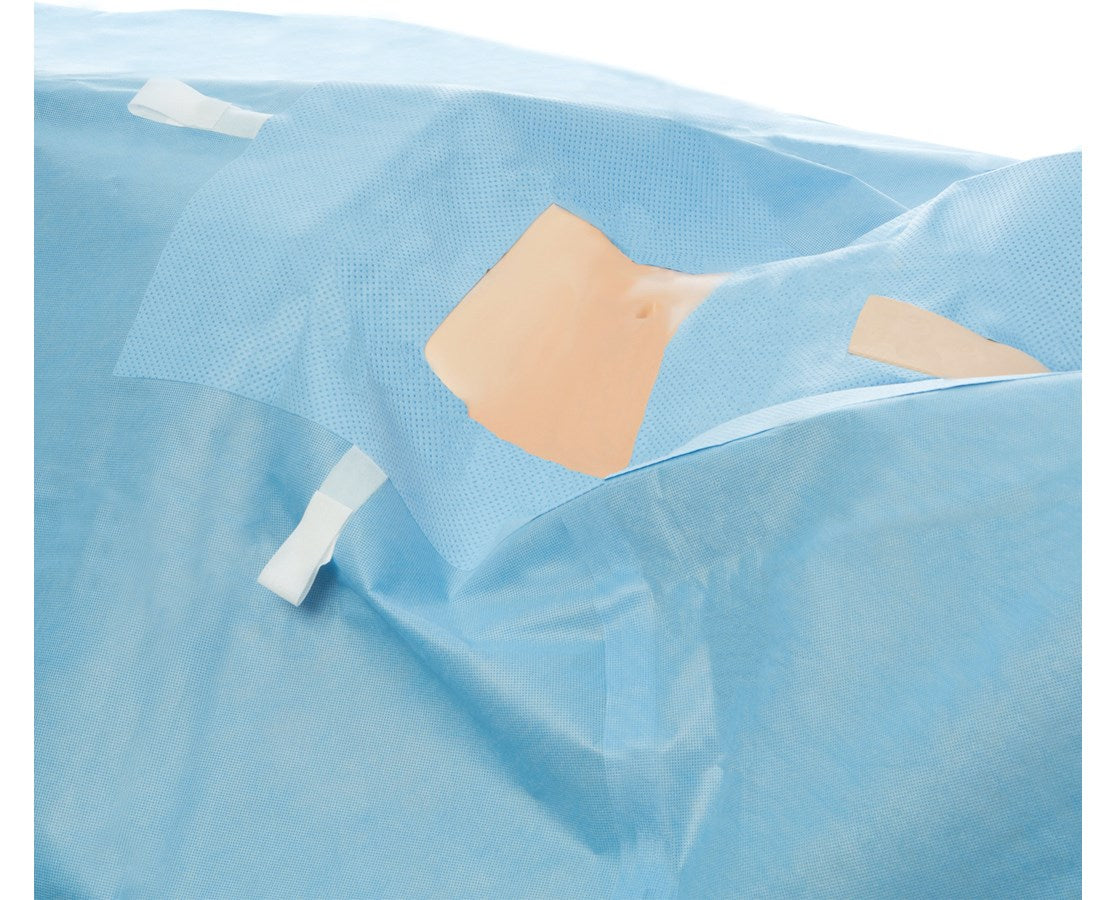 Halyard Laparoscopy/ Lithotomy Drape with Instrument Pouches, 104" x 35 ...