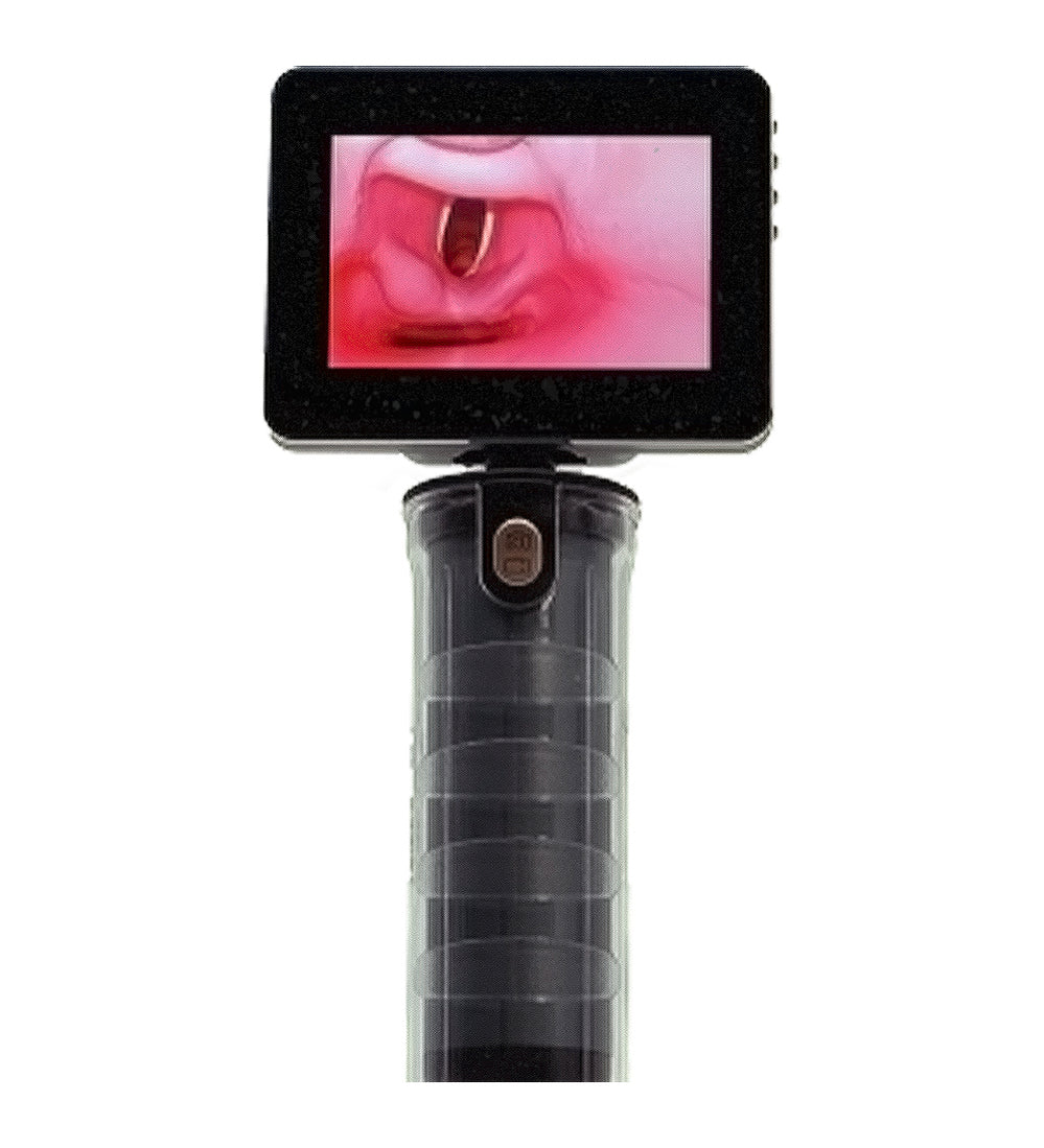 MDPro EZ Vision Video Laryngoscope - Save at — Tiger Medical