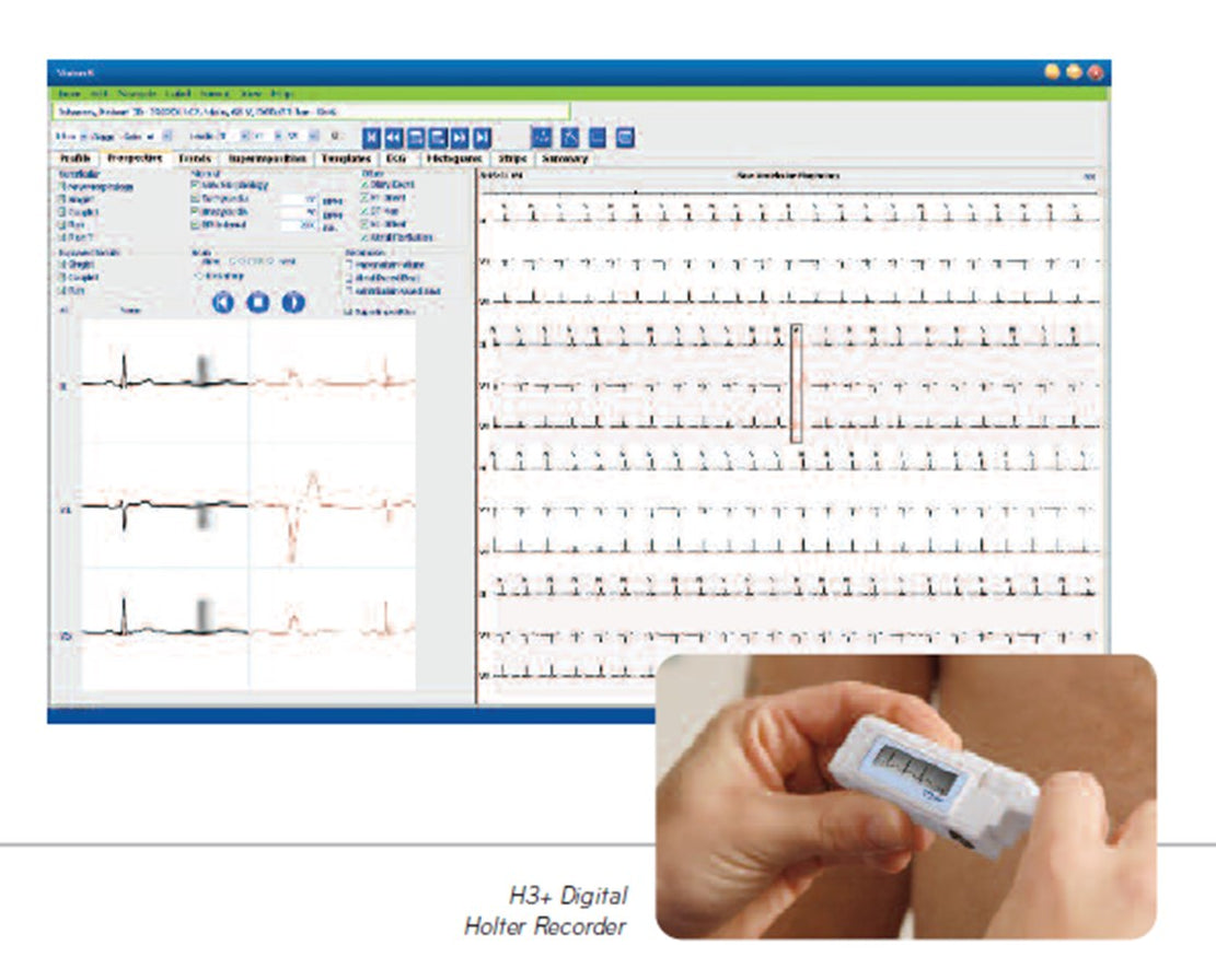 Burdick Vision Express Holter Analysis System - Save at — Tiger Medical