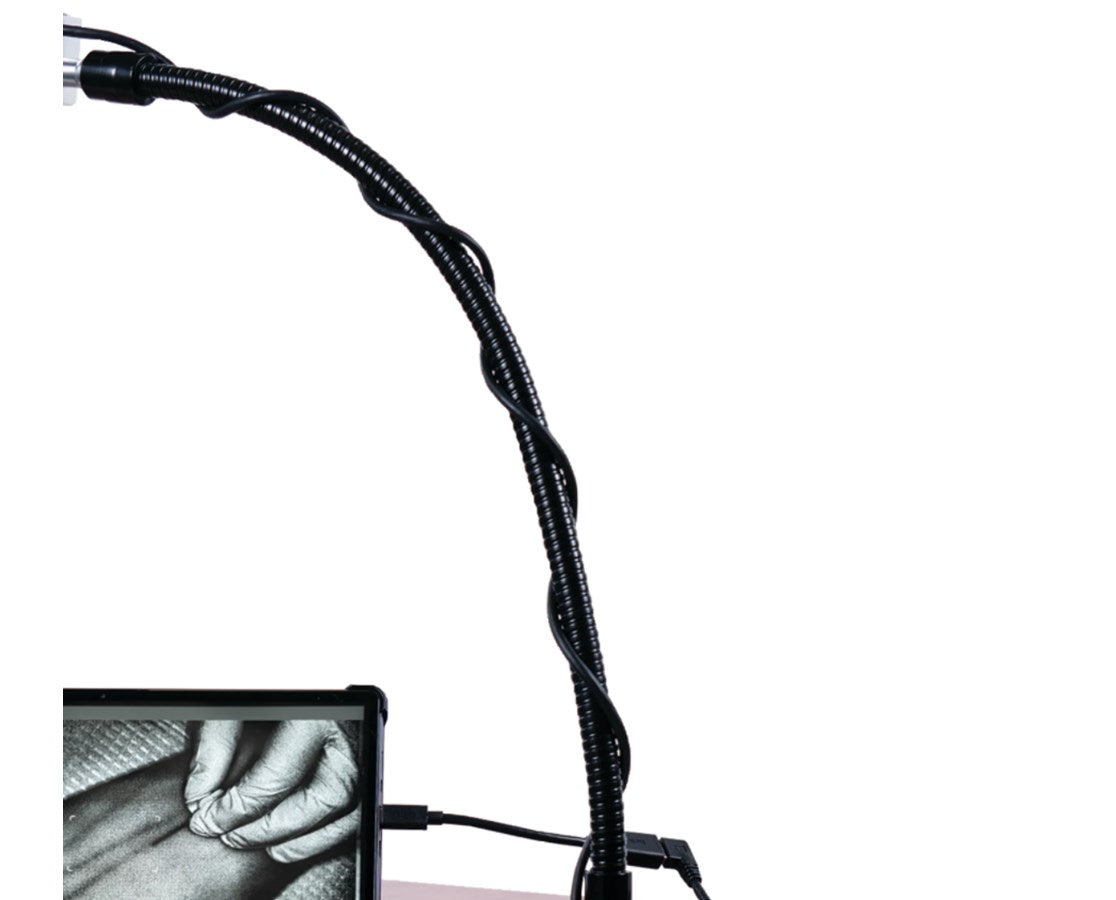 Near Infrared Imaging Gooseneck Tube for Vein-Eye Carry - Save at ...