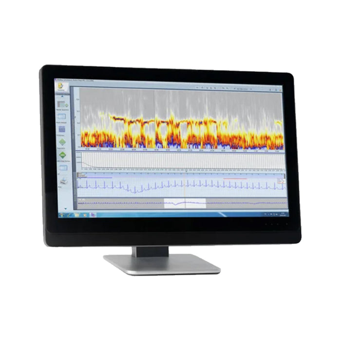 Schiller Medilog Darwin 2 Holter Software - Save At — Tiger Medical