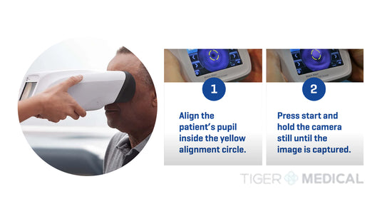 Welch Allyn RetinaVue Handheld Vision Screener - Save at — Tiger Medical