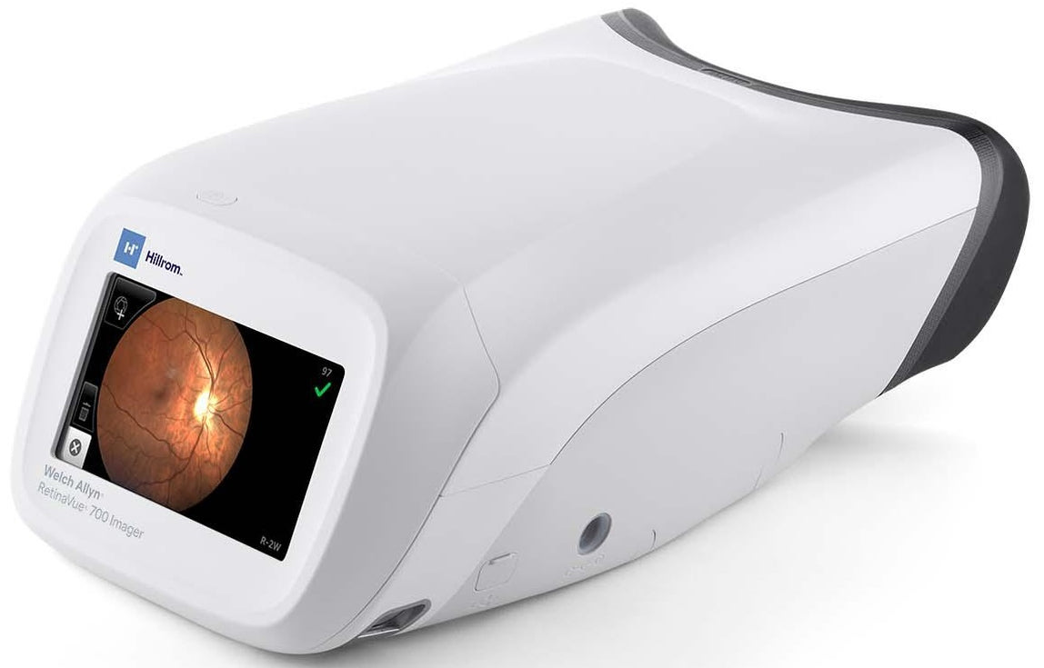 Welch Allyn RetinaVue Handheld Vision Screener - Save at — Tiger Medical